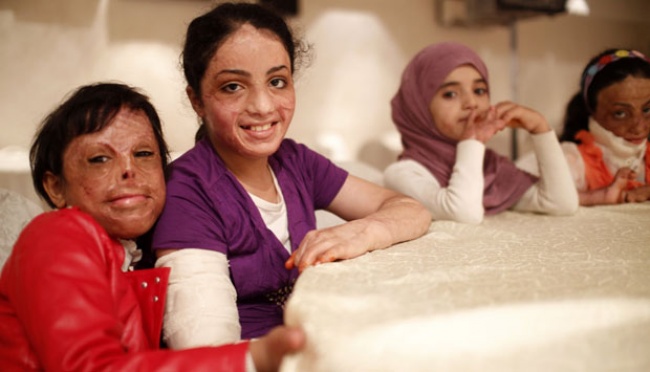 Anak-anak Cacat Fisik Akibat Kekerasan Negaranya Berpesta Bersama ...