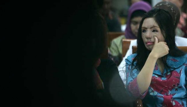 Lisa Face Off Keluar RS Setelah 7 Tahun | tempo.co