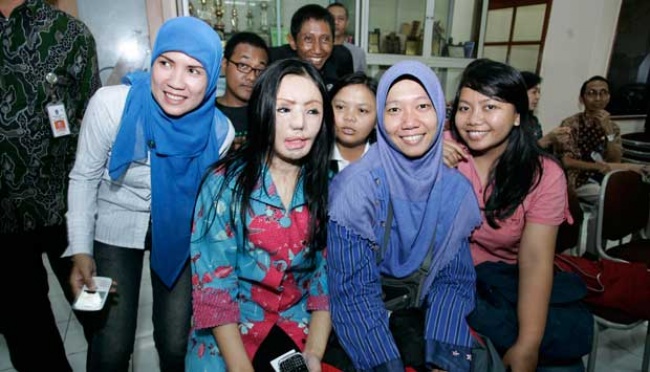 Lisa Face Off Keluar RS Setelah 7 Tahun | tempo.co