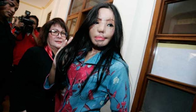 Lisa Face Off Keluar RS Setelah 7 Tahun | tempo.co