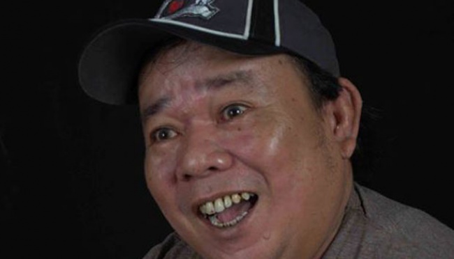 Otong Lenon Wafat karena Sakit Ginjal | tempo.co