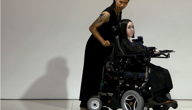 Penyebab Atrofi Otot Tulang Belakang dan Pilihan Pengobatan | tempo.co