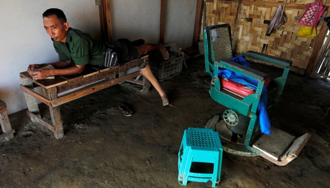 Dibalik Duka Veteran Perang Myanmar yang Kehilangan Kakinya | tempo.co