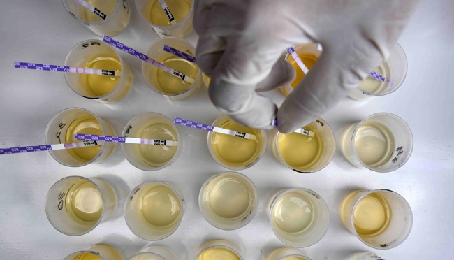 Bagaimana Prosedur Tes Urine untuk Deteksi Narkoba? | tempo.co