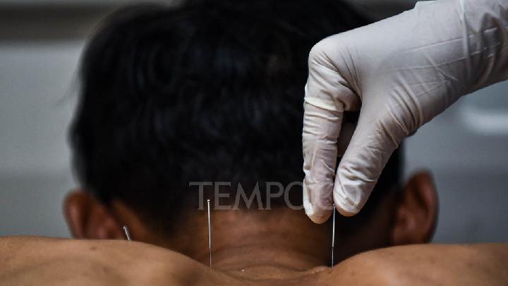 Mengenal Terapi Akupuntur Medik untuk Pengobatan | tempo.co